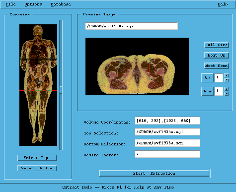 An Interface for the Visible Human Dataset